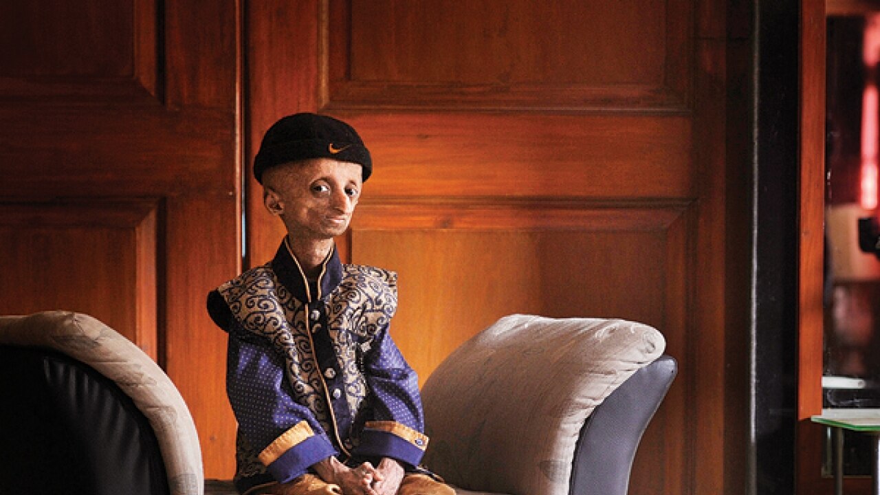 People need to change attitude towards progeria-hit kids, says Nihal Bitla