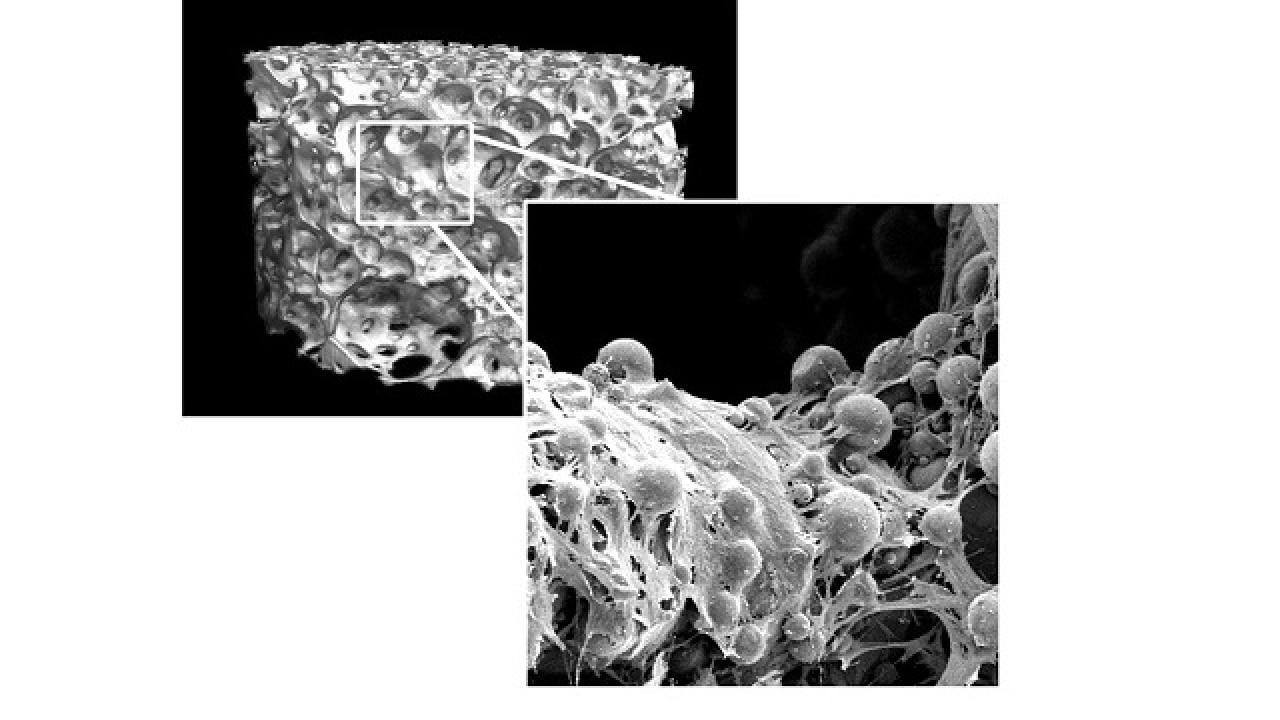 New mechanism helps bone cells regenerate in fractures, reveals new study