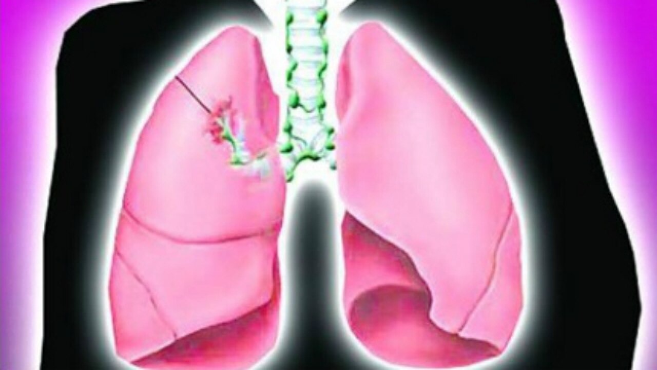 Groundbreaking study identifies molecule that could help battle fatal ...