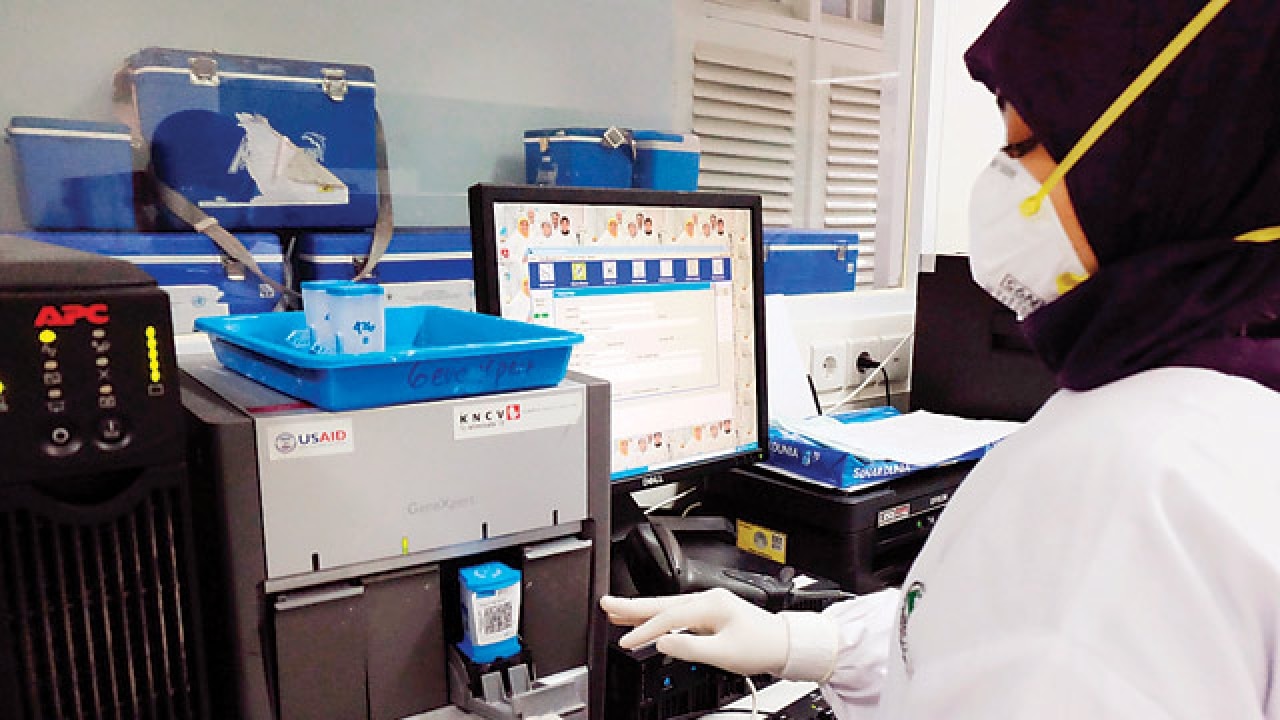 GeneXpert for Tuberculosis can detect viral load in HIV: Study