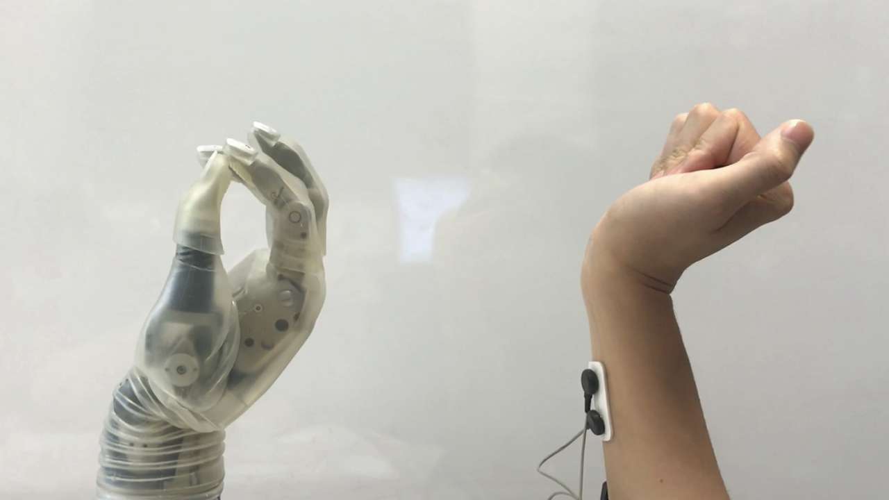 New technology may make prosthetic hands easier for patients to use