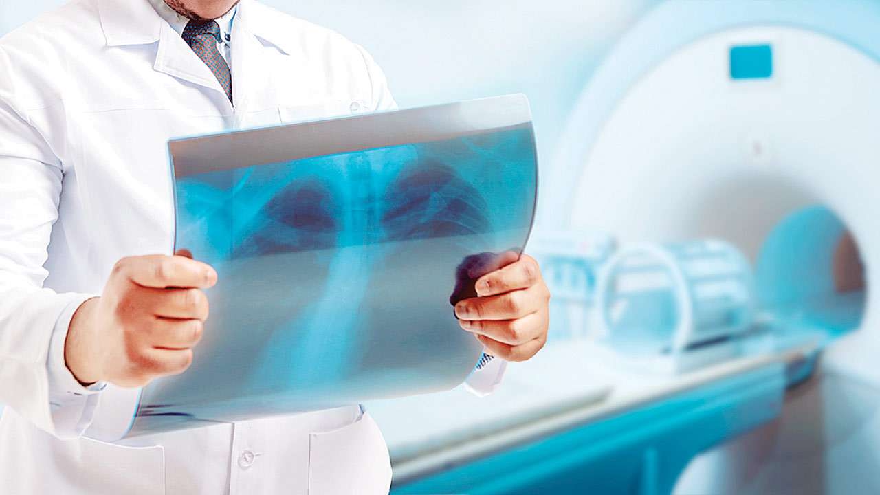 Delhi hospital sets global benchmark in Tomotherapy