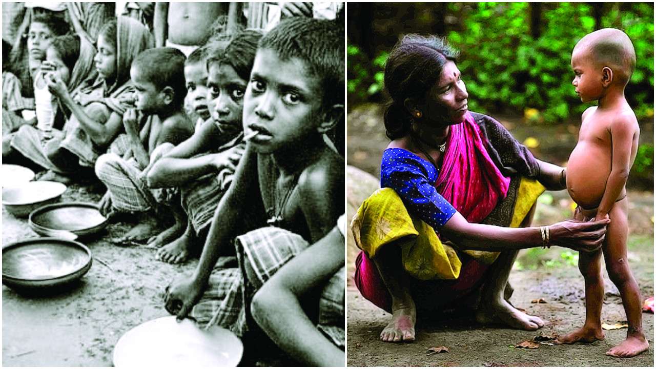 Gujarat spends Rs 12 per malnourished child!