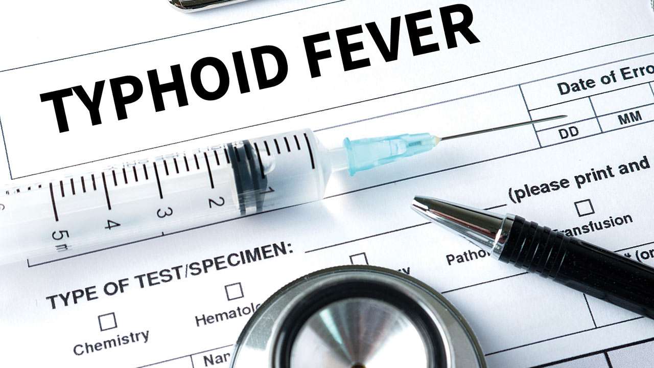 With 600 new cases in August alone, typhoid fever grips Ahmedabad