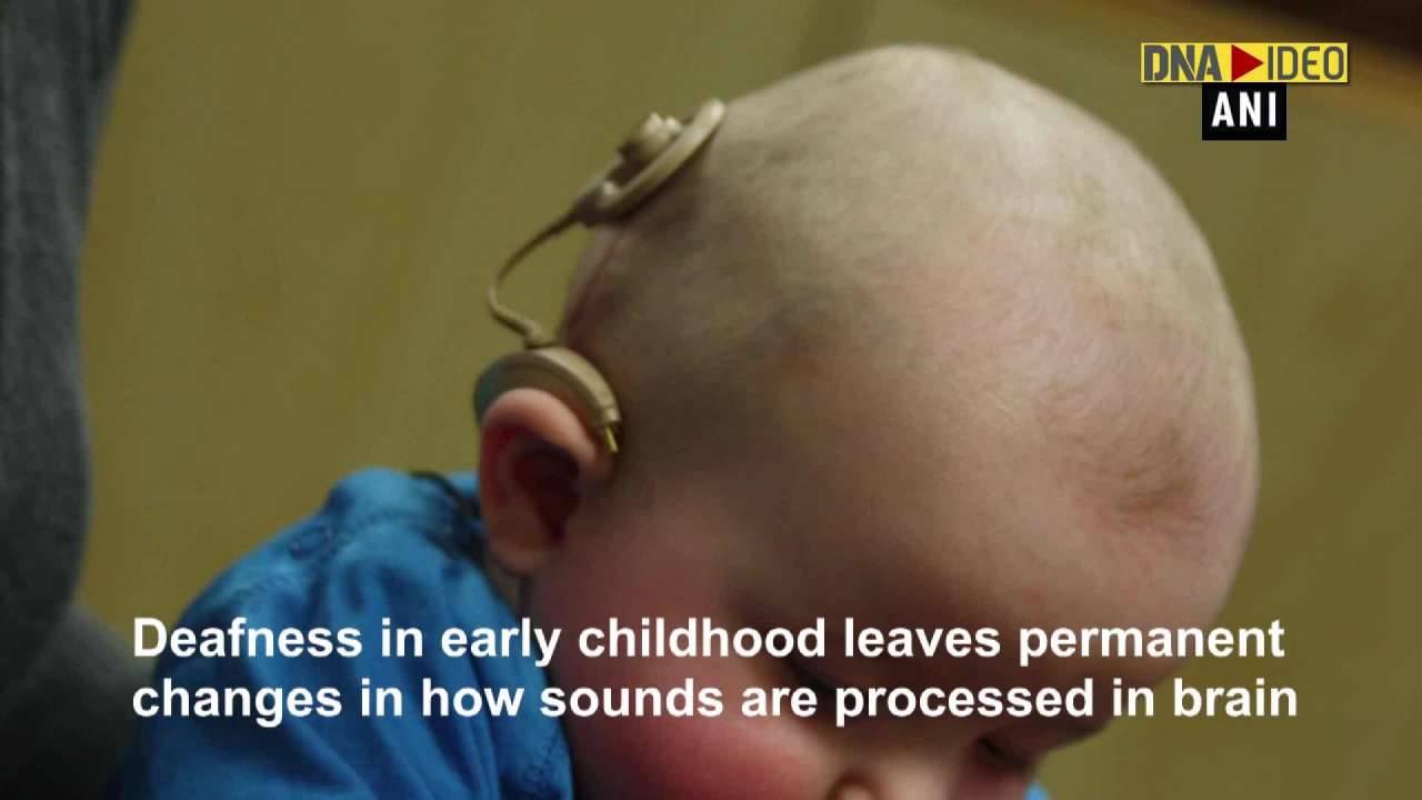 Mild deafness in children leads to changes in how brain processes sound