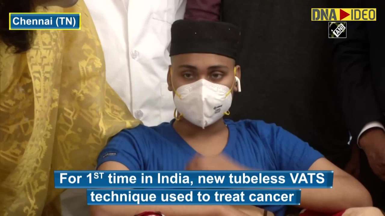 Chennai hospital uses tubeless VATS technique to treat patients with ...