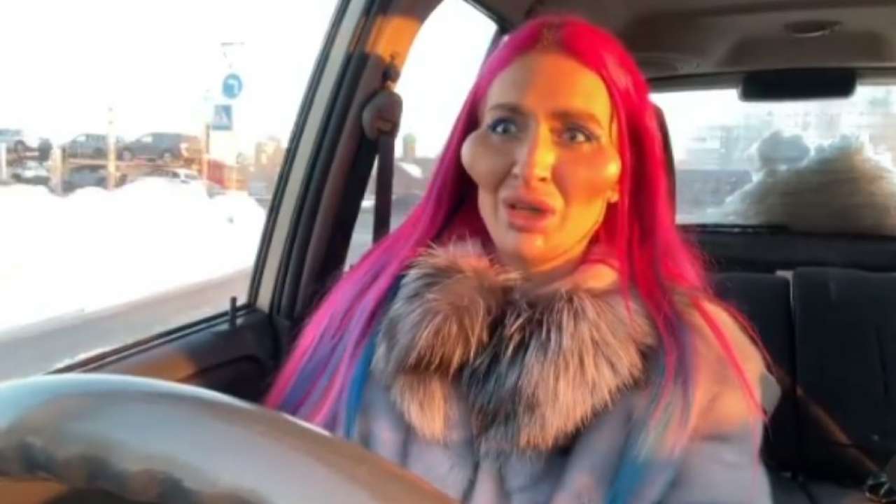 SHOCKING! Woman with ‘world’s biggest cheeks’ looked completely ...