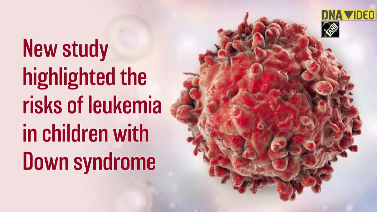 Study suggests risk of leukemia higher in children with Down syndrome