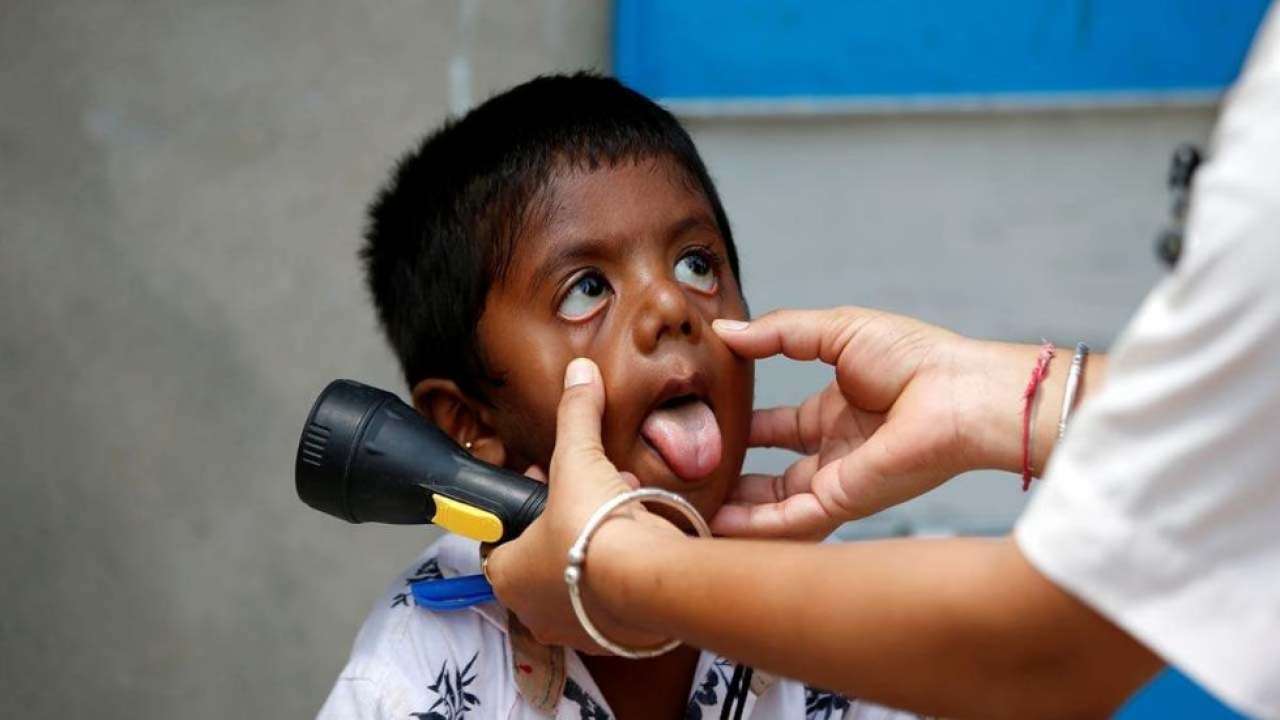 Covid-19 management guidelines for children revised - What's ...