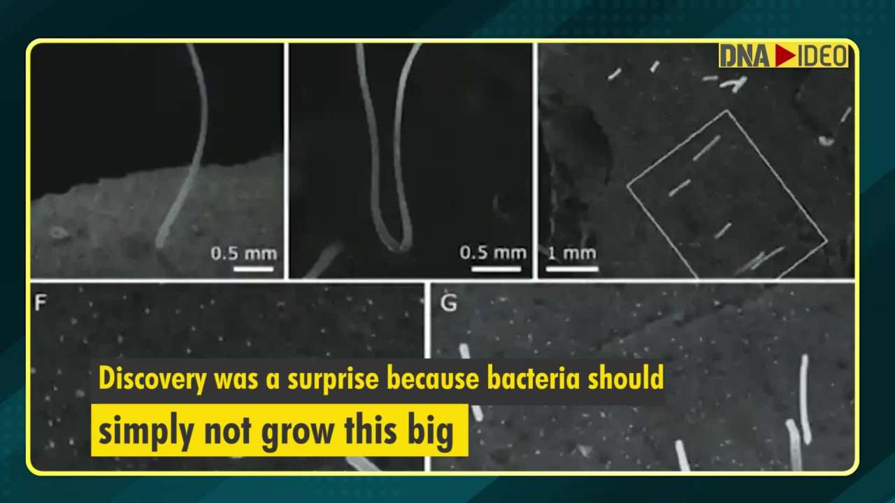 Major Breakthrough! Largest bacteria ever to exist discovered