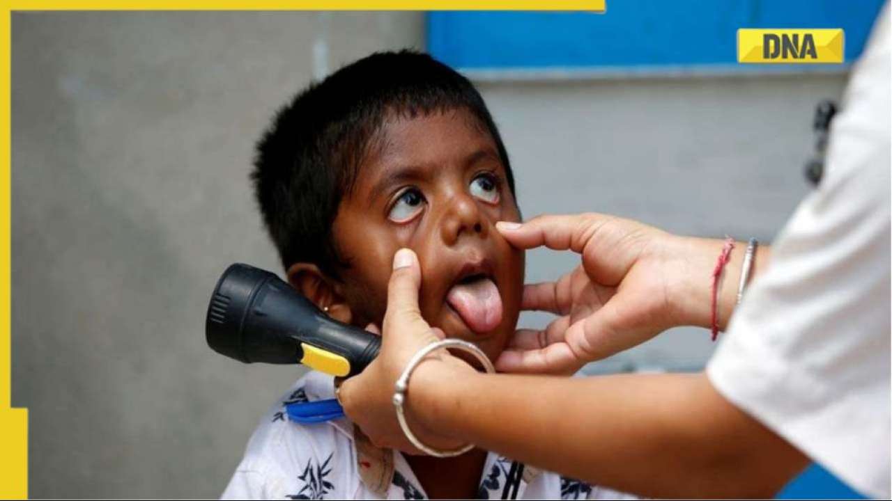 Covid-19: Children below 12 years have lower chance of contracting ...