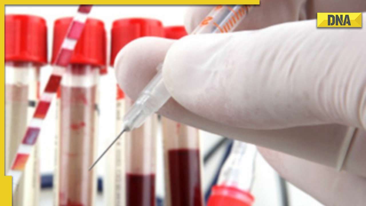 Unique blood group found in Gujarat man, first case in India and 10th ...