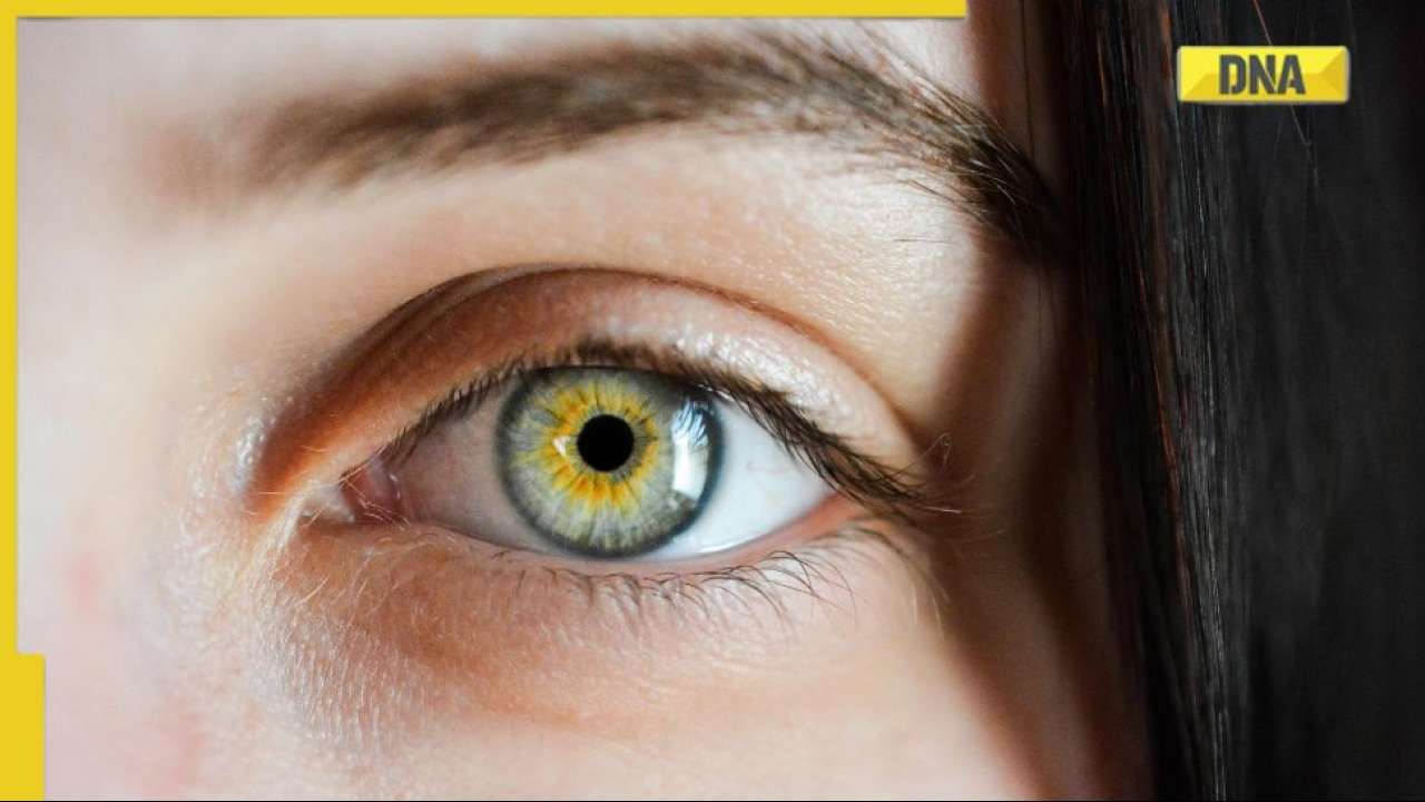 Uveitis in Eyes: How swelling and irritation occur? Know about the new ...