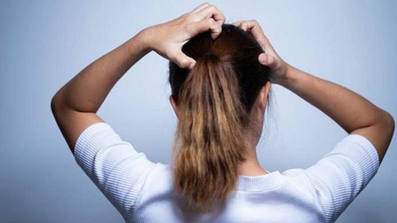 Lice Problem: जूं और लीखों से हैं परेशान? चुटकियों में पाएं इनसे ऐसे ...