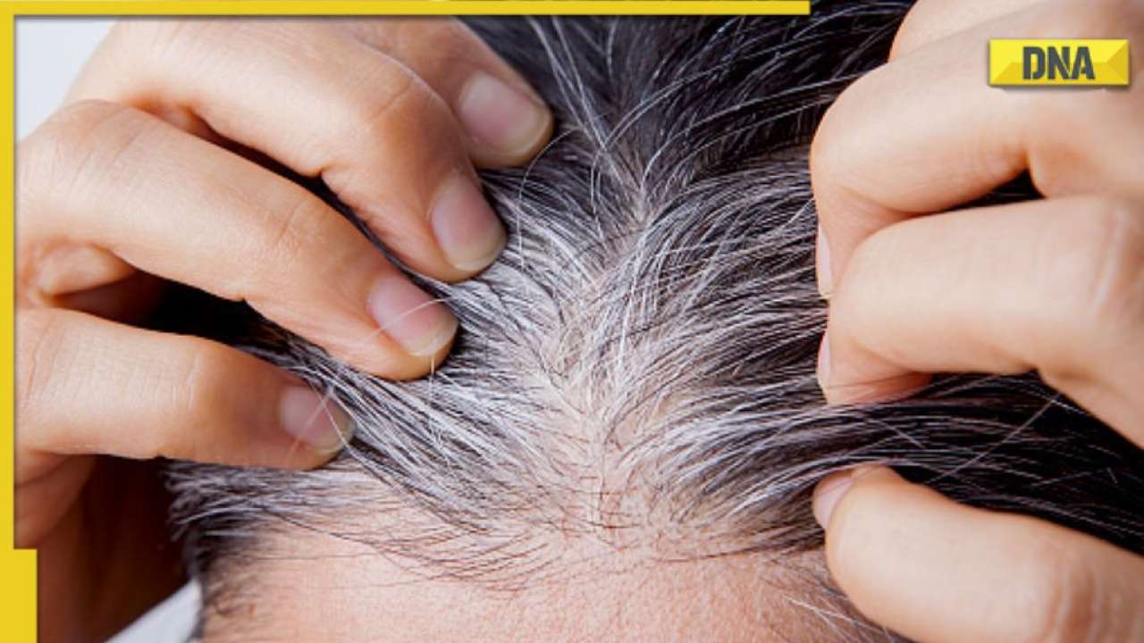 Hair turning white early? Check out these 5 natural remedies to prevent ...