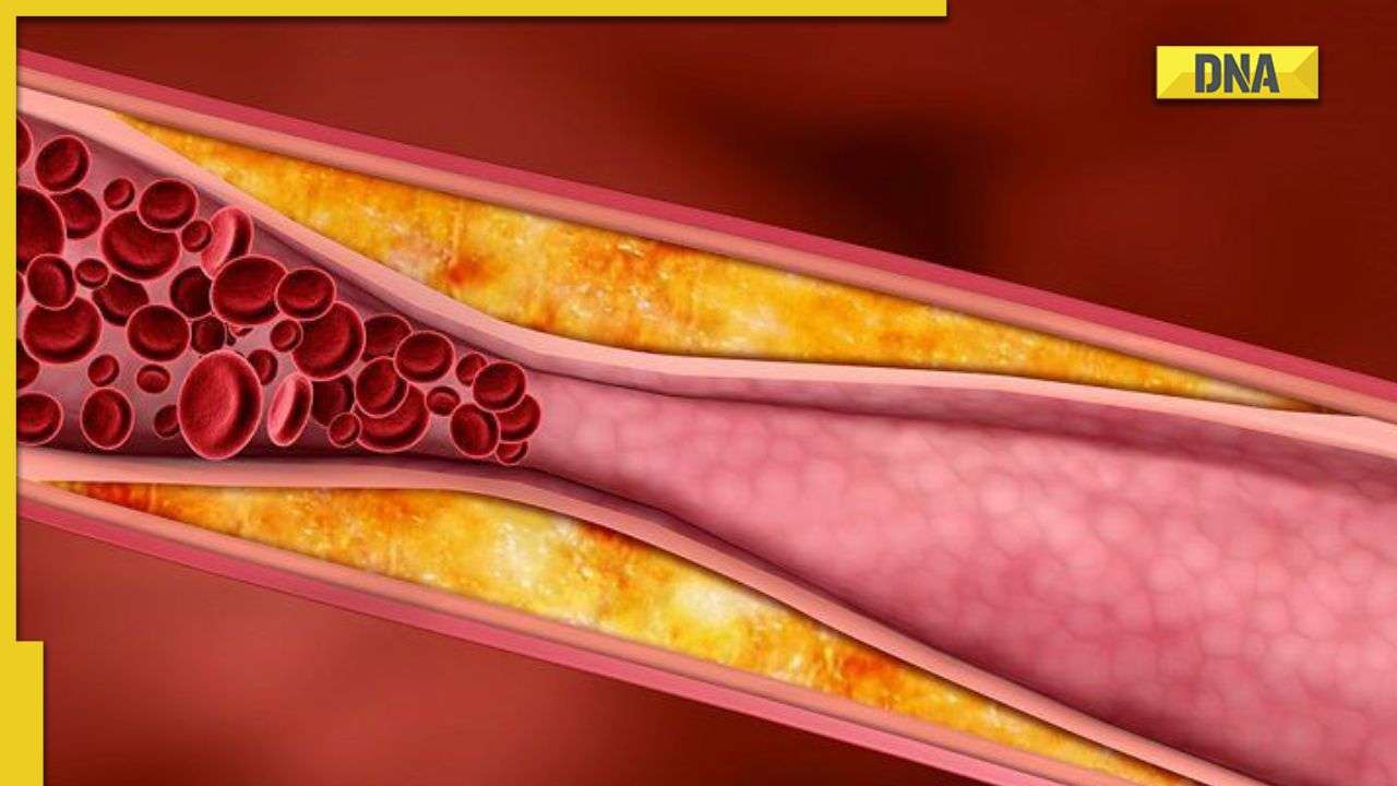 All you need to know about the symptoms of coronary artery blockage
