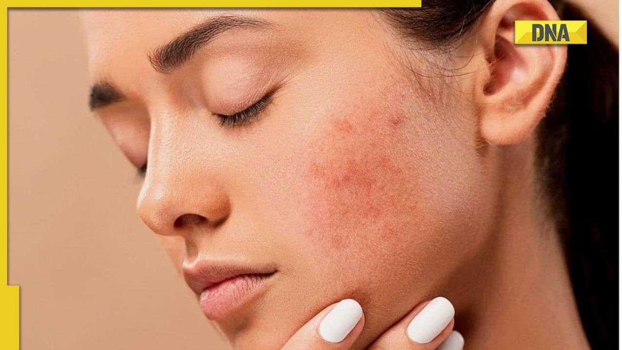 4 common mistakes that may be damaging your skin