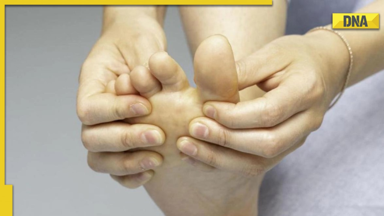 What are skin fungal infections? Know 8 natural treatments to cure the skin