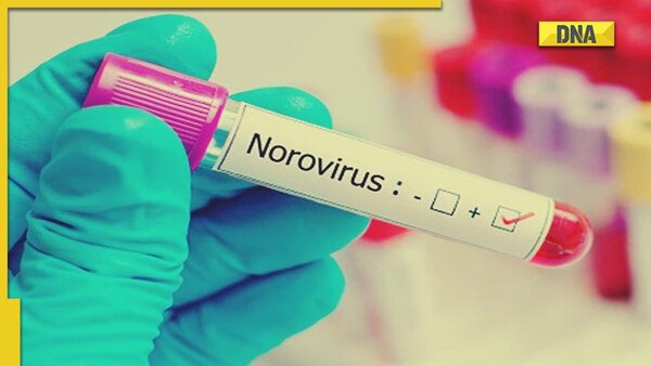 Norovirus cases in Kerala: Know all about virus, symptoms, causes and how dangerous is it?