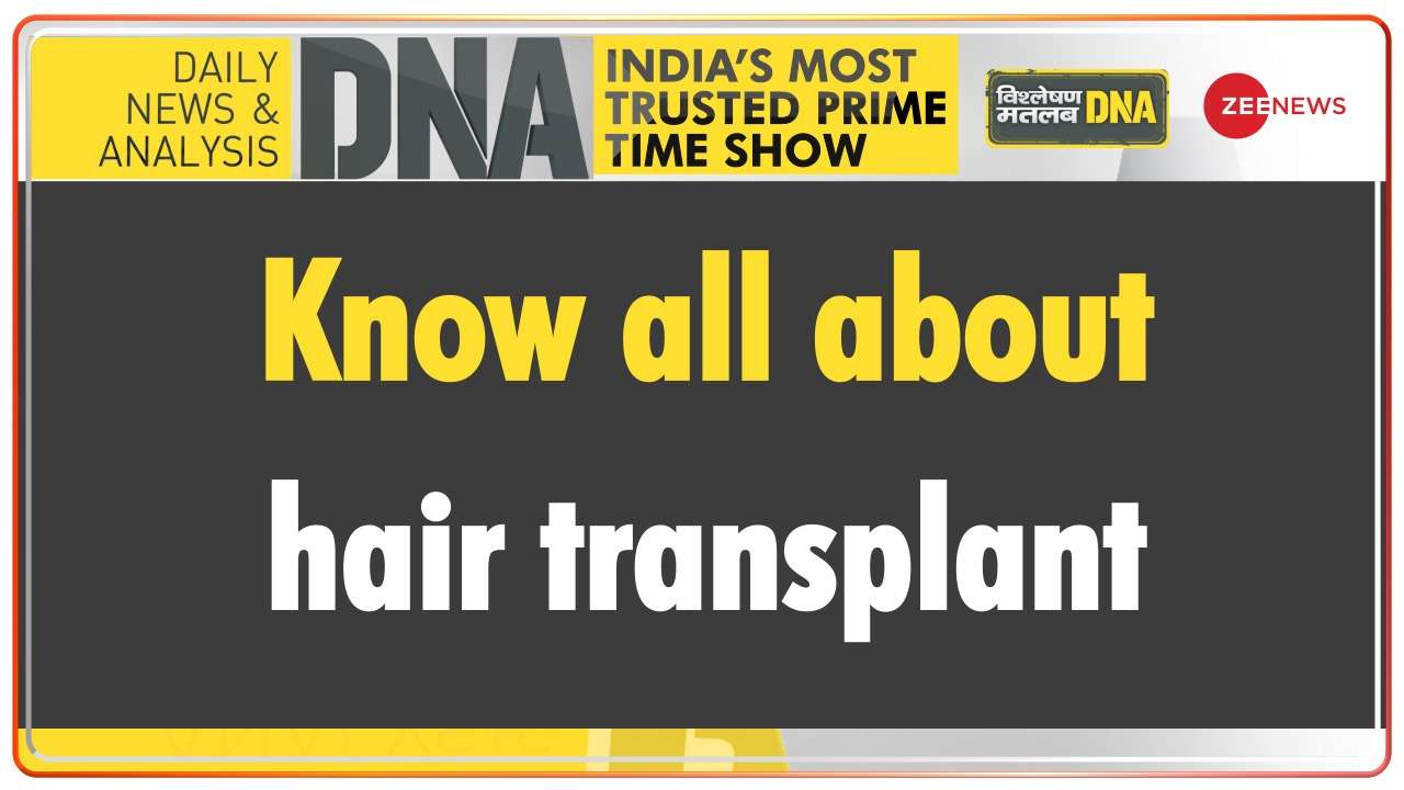 DNA | Know all about hair transplant