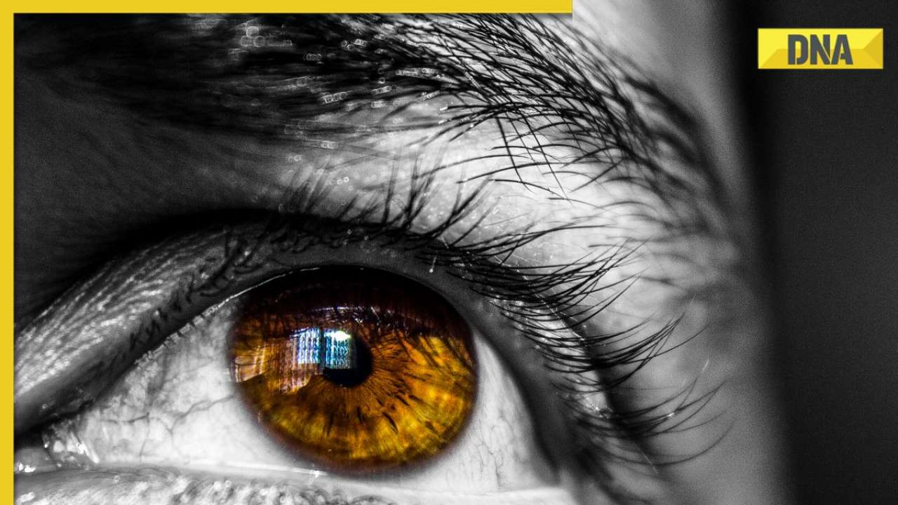 DNA Special: What is Computer Vision Syndrome? Know cause, 20-20-20 ...