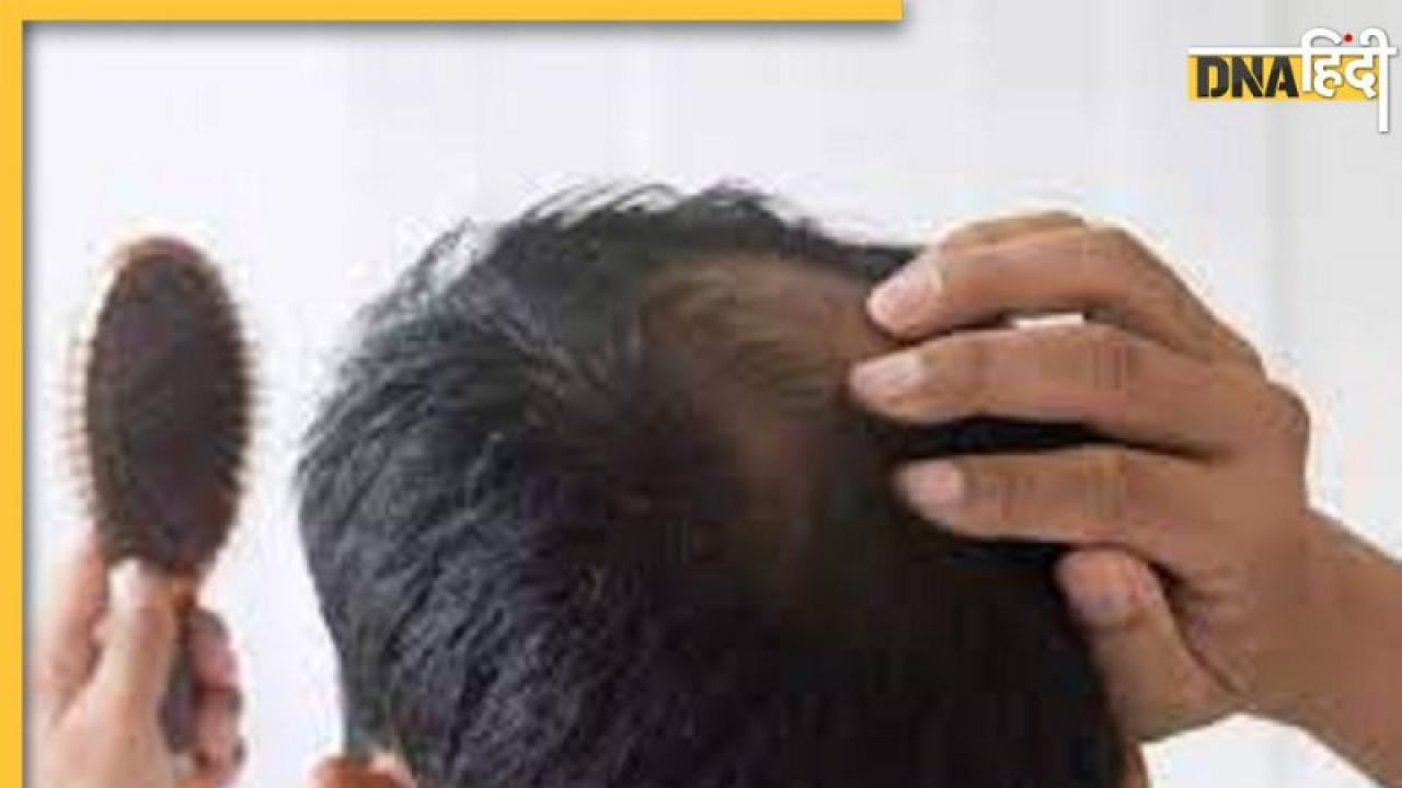Hair fall Latest News and Updates in Hindi – Hair fall के समाचार,ताज़ा ...