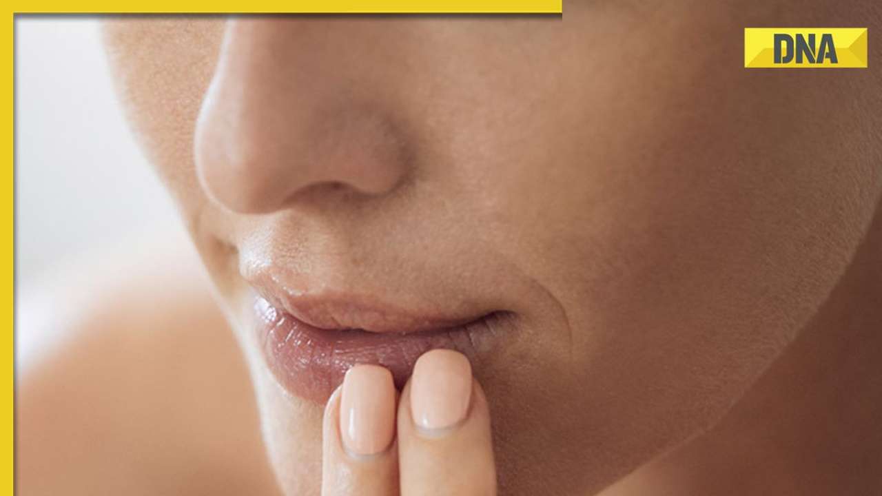Try these 5 effective home remedies to get rid of pigmented lips