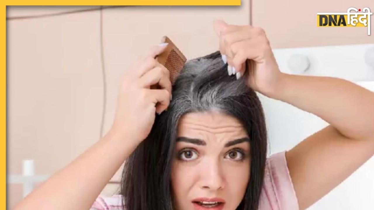 White Hair Problem Latest News and Updates in Hindi – White Hair ...
