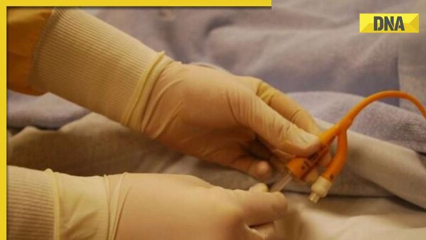 Fowler's syndrome: All you need to know about this rare condition