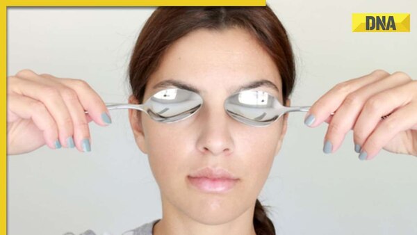 Try this cool method 'cold spoon therapy' to depuff your eye bags