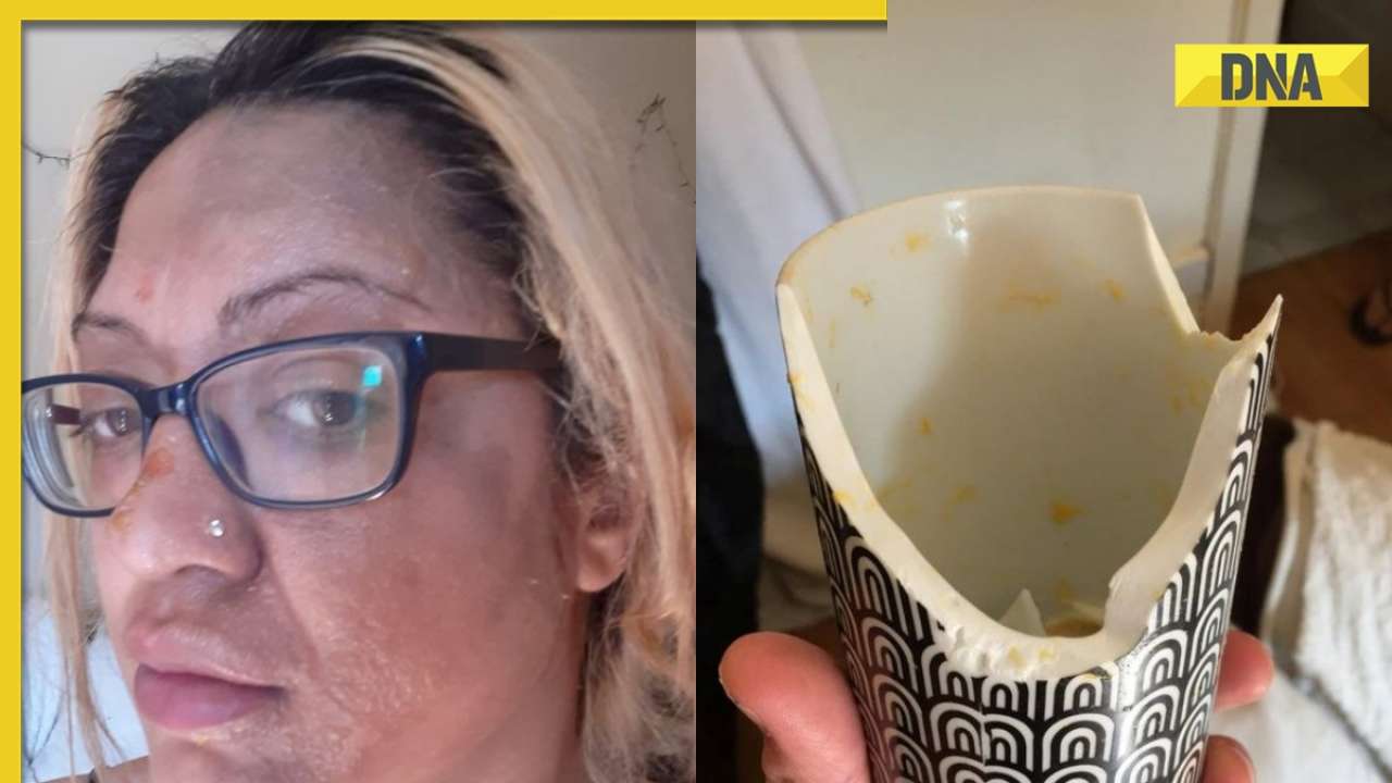 TikTok cooking hack gone wrong: Woman suffers facial burns while ...
