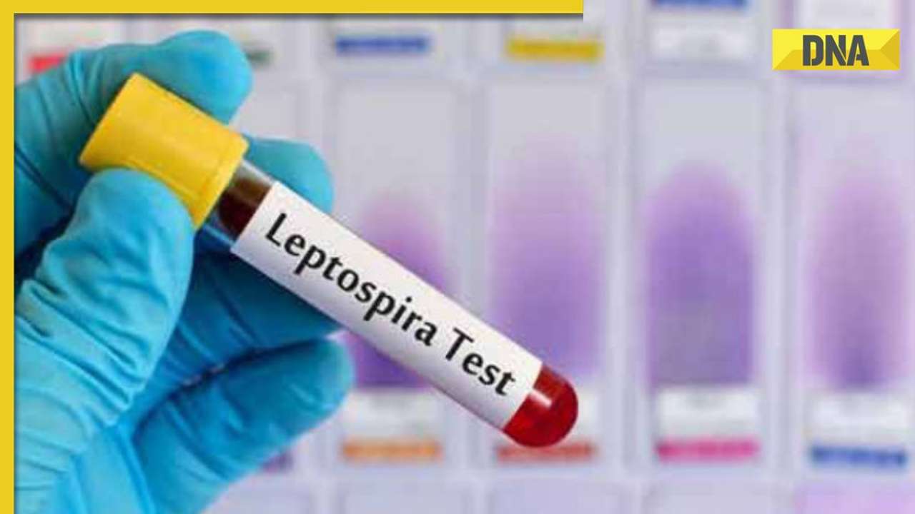 What is Rat Fever outbreak in Kerala? know symptoms, treatment