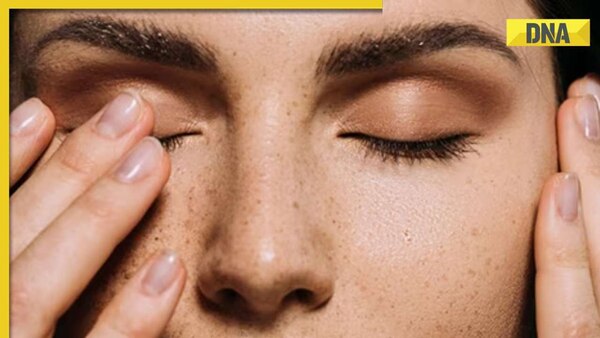 Why do some people have freckles? Here's how they form