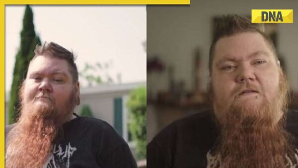 Meet woman who set Guinness World Record for longest beard on a female