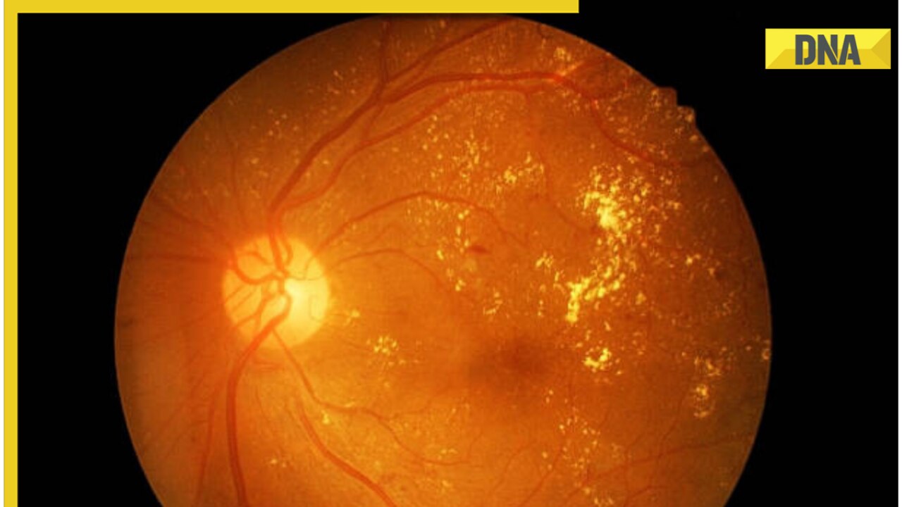 6 ayurvedic herbs you can try for good macula health