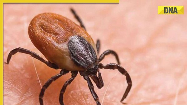 What is scrub typhus, a bacterial infection rising in India? Know ...