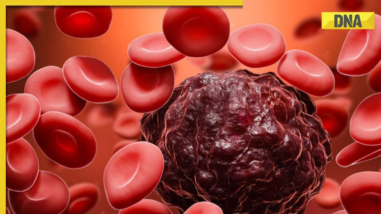 Blood Cancer Awareness Month 2023: 5 types of blood cancer you should know