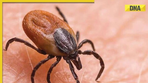 Scrub Typhus: Mite-borne infection kills 5 in Odisha, 9 in Shimla; all ...