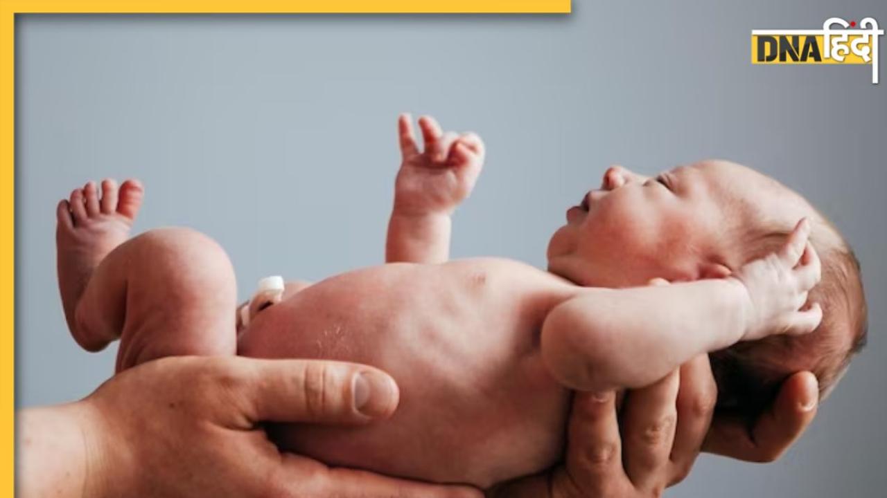 Birth Defect Latest News and Updates in Hindi – Birth Defect के समाचार ...