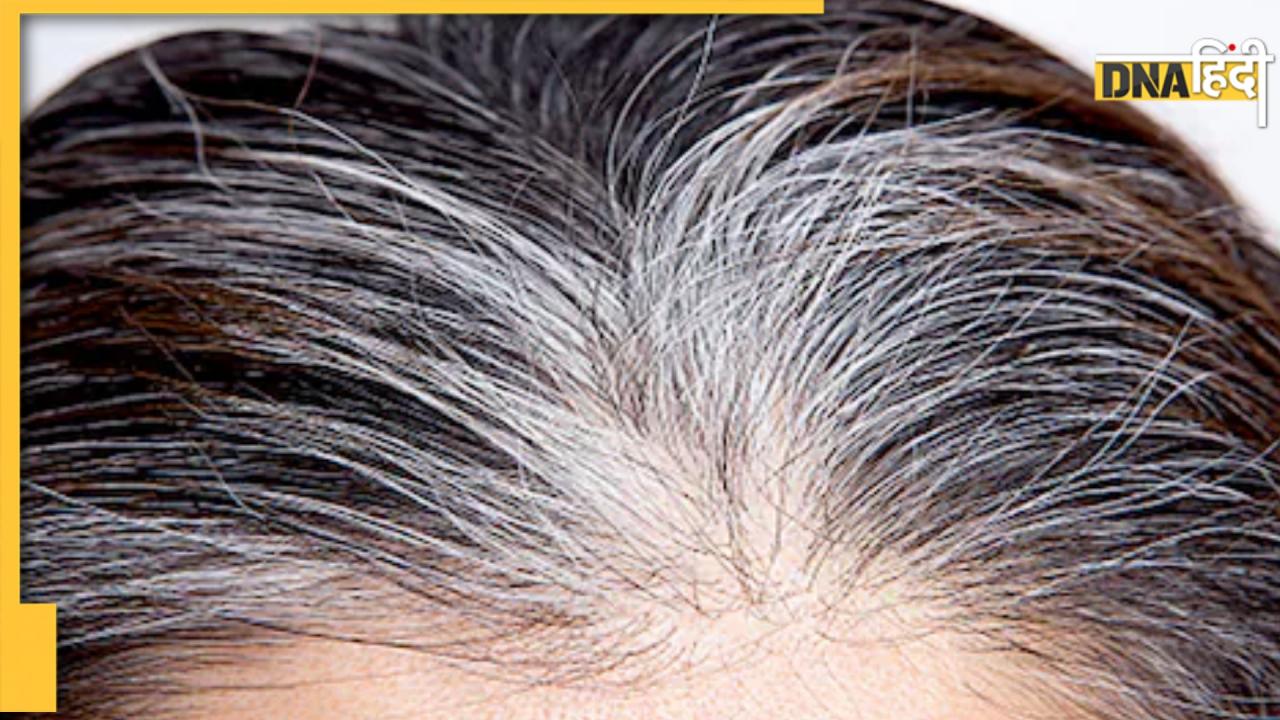 White Hair Solution: 15 दिन में बालों को जड़ से काला करेंगी ये 5 चीजें ...