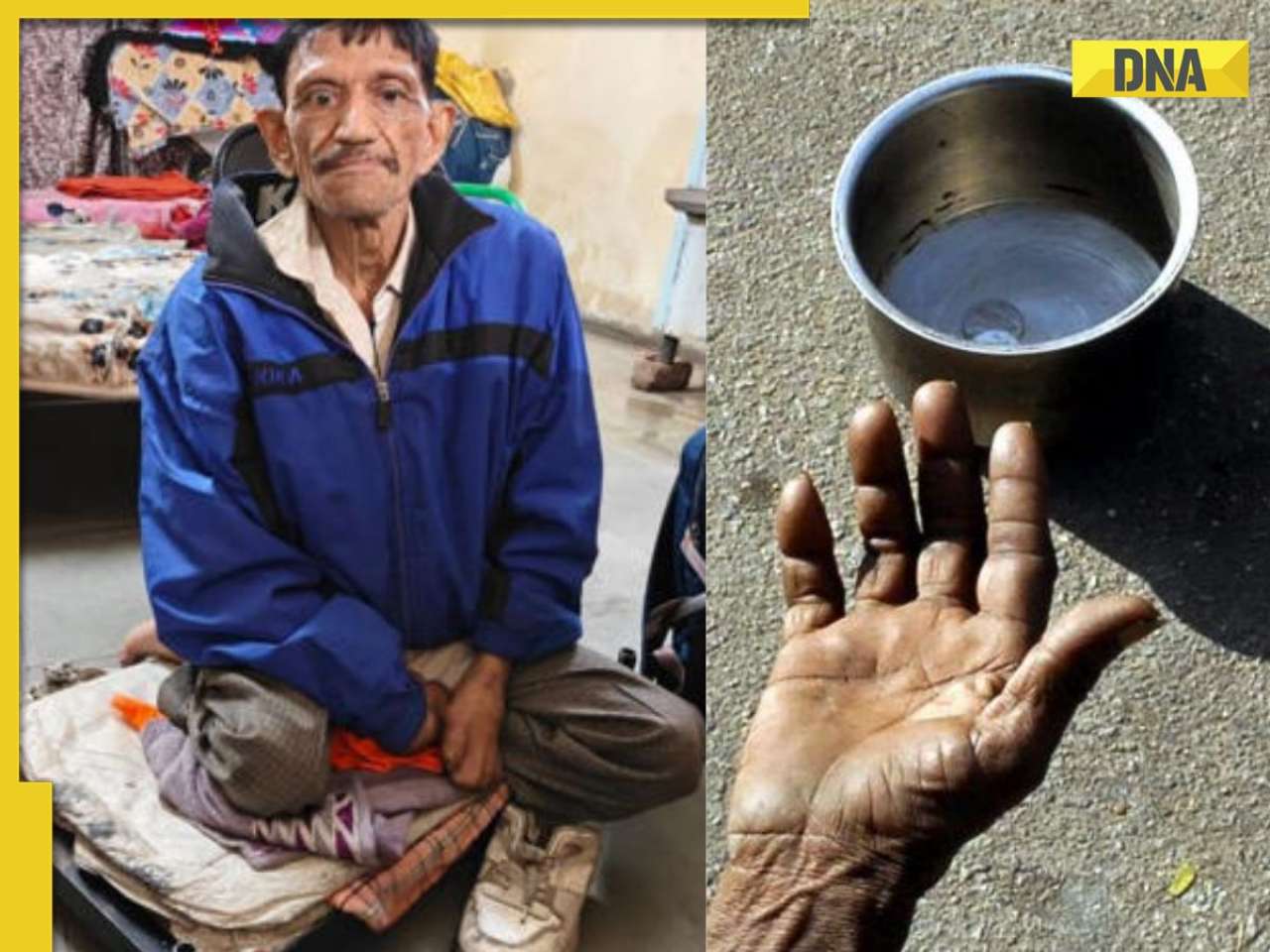 How an Indore beggar became crorepati, owns 3 homes, 3 auto-rickshaws ...