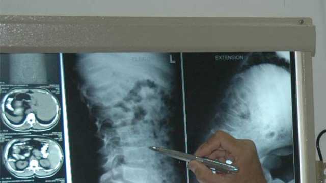 X-Rays and their harmful effects