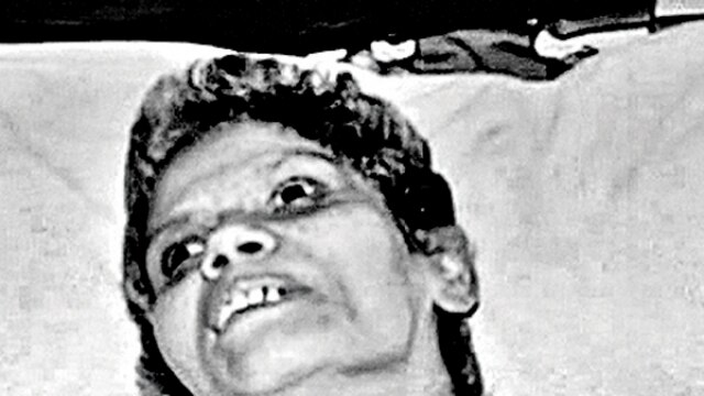 Aruna Shanbaug's case is rare in medical history: Doctors