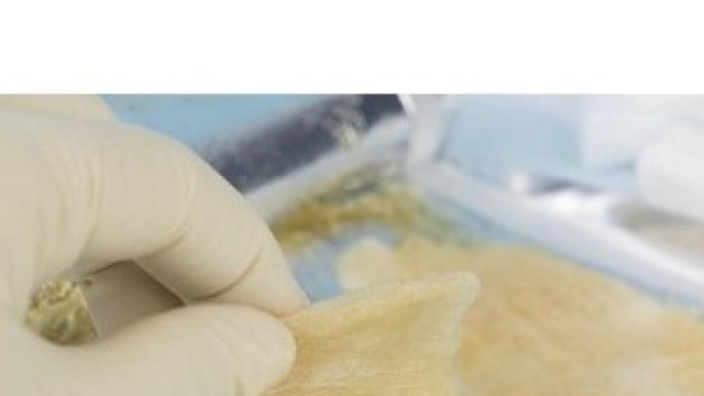 Elastic gel that can instantly heal wounds developed