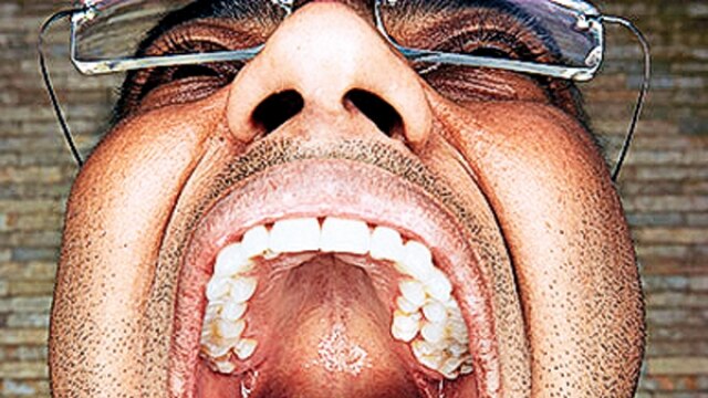 India has 'most teeth' in Guinness records