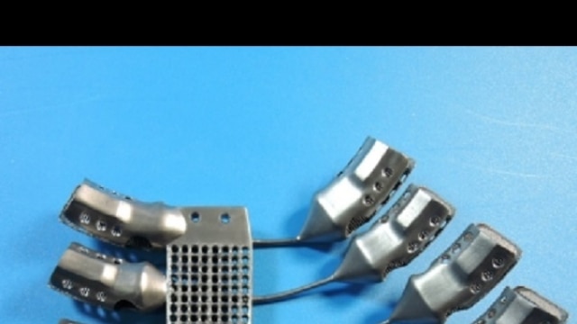 Cancer patient receives 3D printed ribs in world first surgery