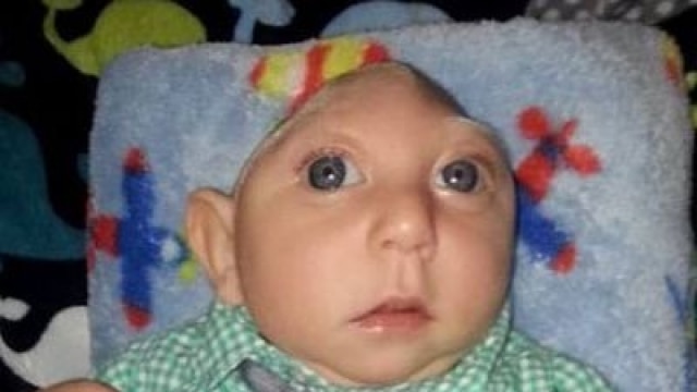 Watch: A baby without a skull celebrates his birthday