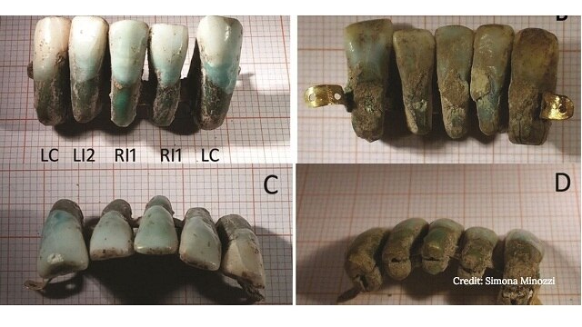 400-year-old false teeth found in Italy