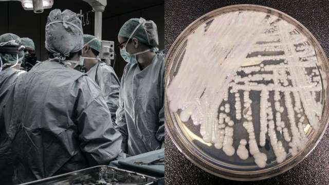Potentially fatal and untreatable "superbug" fungus outbreaks reported ...