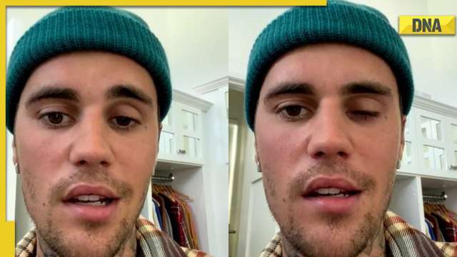 Justin Bieber shares update on his health condition, says 'horrible ...